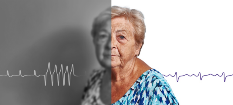 What James Bond got right – and wrong – about digitalis toxicity - SERB ...