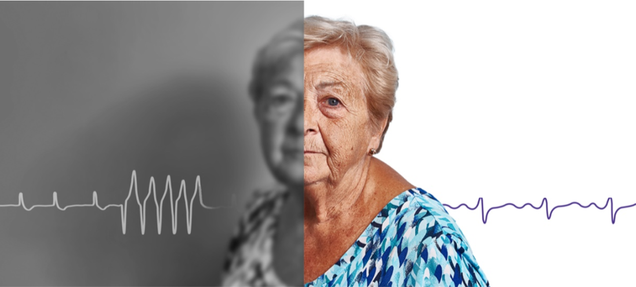 Did digitalis affect Van Gogh’s painting? - SERB Pharmaceuticals